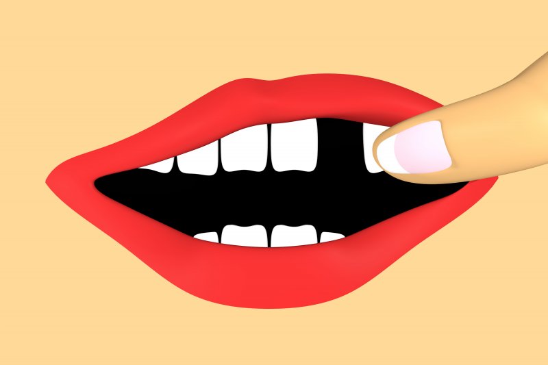 Can You Put a Knocked-Out Tooth Back in Yourself | Dr. Brad McConnell